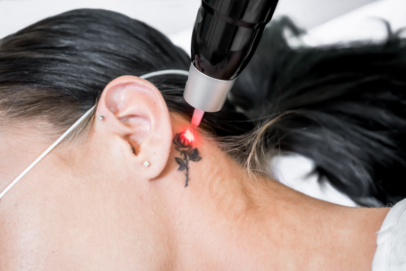 Evaluating the Real Business Value of Picosecond Laser Platforms ...
